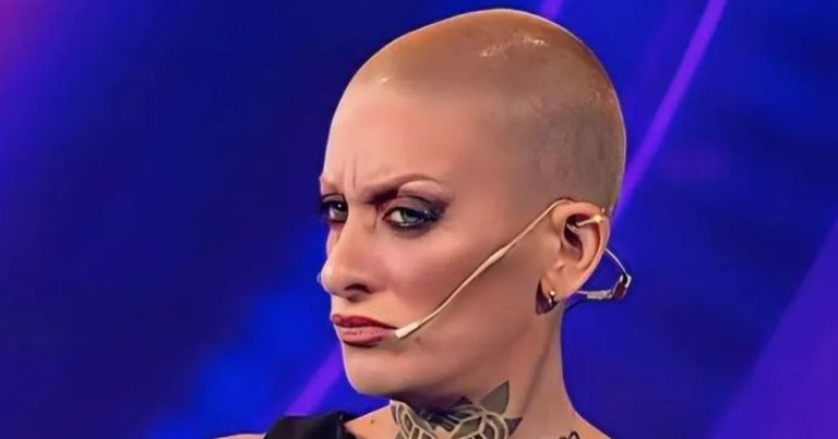 ¿Qué se hizo? Así quedó la cara de Furia tras un retoque estético ...